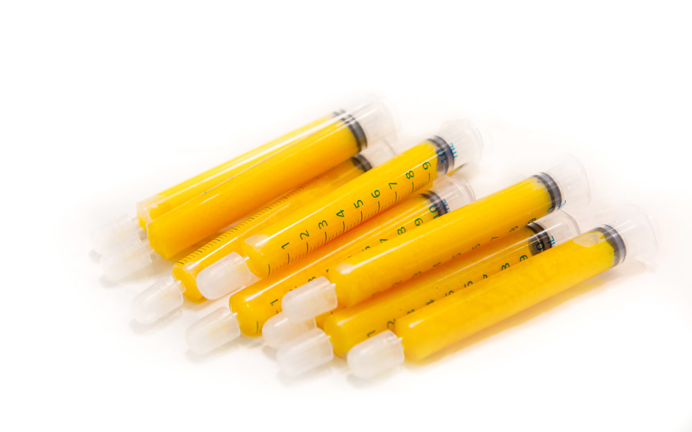 Reconstruction mammaire par lipofilling (ou transfert de graisse ...